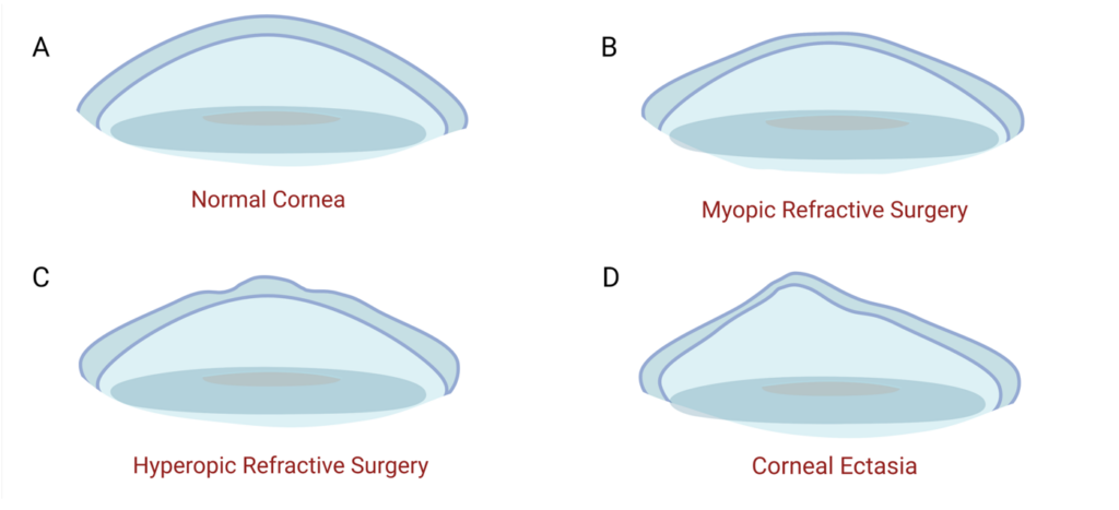 Moran CORE | Essentials of Biometry (Part 3): What are common ...